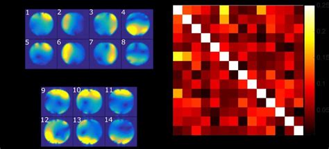 a individual sensitivity maps for coils shown as axial slices through