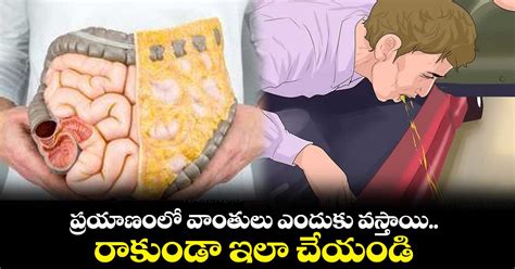 ప్రయాణంలో వాంతులు ఎందుకు వస్తాయి రాకుండా ఇలా చేయండి