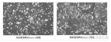 人结直肠腺癌细胞 Caco 2 培养要点 知乎