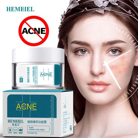 HEMEIEL Acne Remover Cream Pimples Remover Effective Pimple Marks Remover Pang Tangal Ng