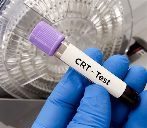 10 Clot Retraction Royalty Free Photos And Stock Images Shutterstock