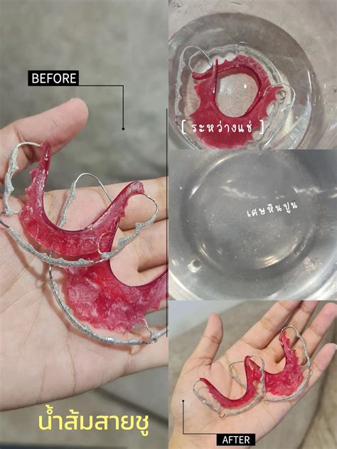 มาดูกันว่าใช้อะไรแช่รีเทนเนอร์ ได้บ้าง แกลเลอรีที่โพสต์โดย Pp Papit Lemon8