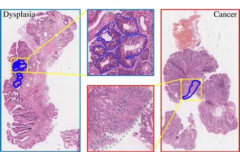 Figure 1 From Rmdl Recalibrated Multi Instance Deep Learning For Whole