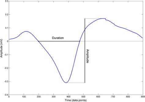 Representative Tracing Of A Single Motor Unit Action Potential And How