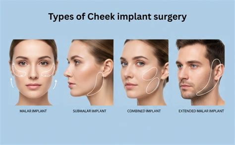 Cheek Implant Surgery Medisuggest