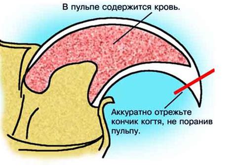Кошачьи коготки