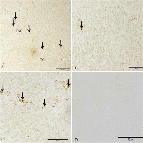Photomicrographs Of Ghrelin Immunopositive Ghrelin Ip Cells In The Download Scientific