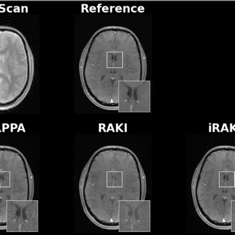 A Pre Scan Top Row Served As Training Data For Image Reconstructions Download Scientific