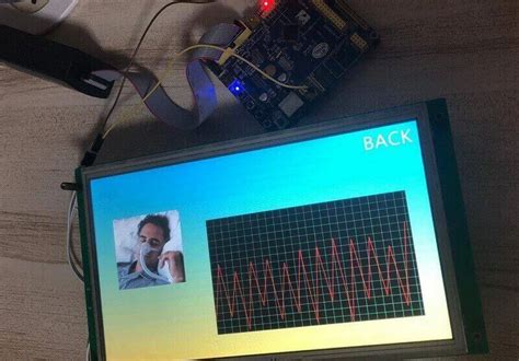 Medical Ventilator Stone Touch Screen Stm32 Project Functions