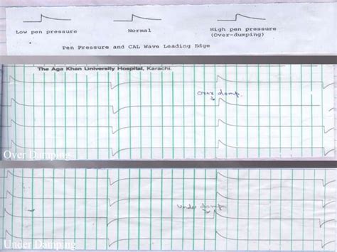 Eeg Machine Calibration Pptx