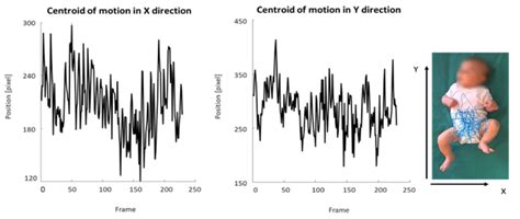 graphic representation of the centroid of motion in the x and y download scientific diagram