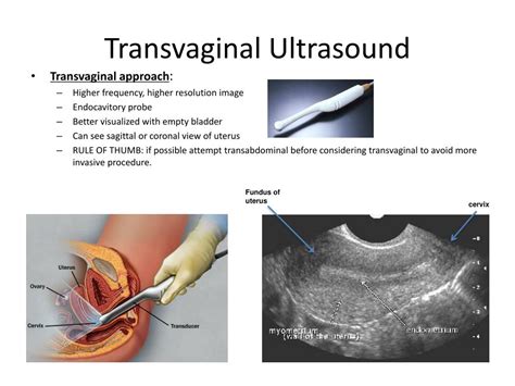 Fetal Ultrasound Transducer Frequency At Sophia Hoff Blog