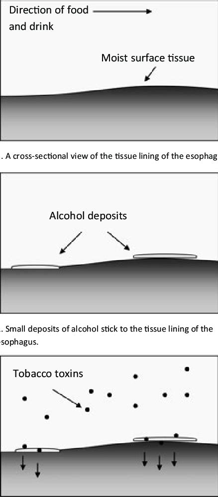 Three Simplified Diagrams Illustrating The Hypothesized Causal