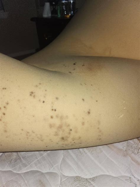 Evidence Of Bed Bug Cant Find Any Other Trace R Bedbugs