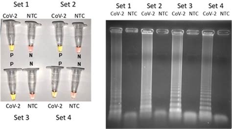 Colorimetric Rt Lamp Reaction For Sars Cov 2 2400 Copies Using Four