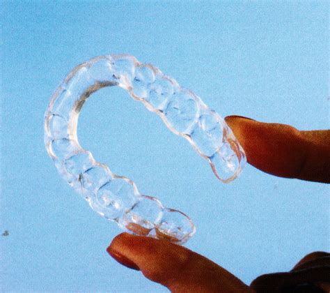Occlusal Splints Flexident