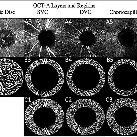 Shows Examples Of Oct A En Face Images A16 Original Oct A Macular Download Scientific Shows Examples Of Oct A En Face Images A16 Original Oct A Macular Download Scientific