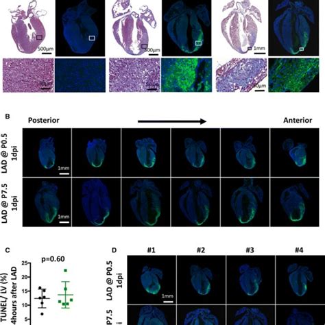 Apex Forming Right Ventricle A Long Axis And B Serial Short Axis Download Scientific Diagram