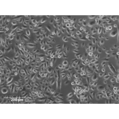 Human Bronchial Epithelial Cells Hbepc