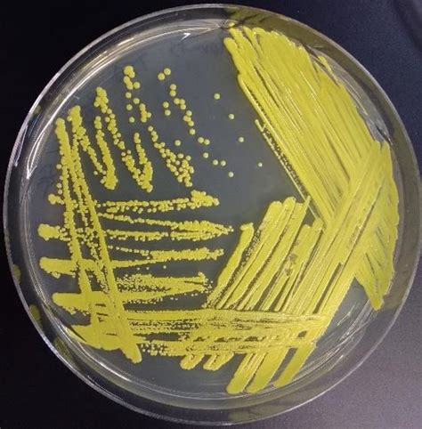What Is The Principle Of Streak Plate Method At Brianna Gellatly Blog