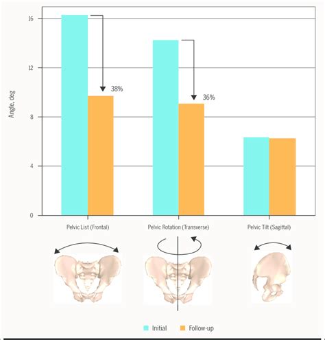 Angular Excursion Of The Pelvis Was Measured During Treadmill Running