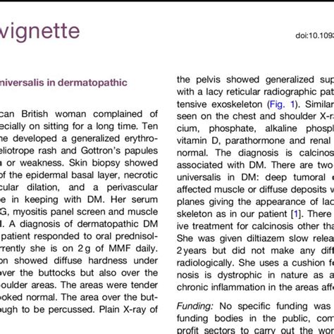 Plain X Ray Of The Pelvis Showing Generalized Superficial Calcification Download Scientific