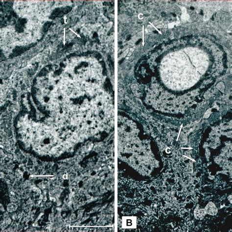 Control And H 2 S Group Of Sulcular Epithelium And Subepithelial
