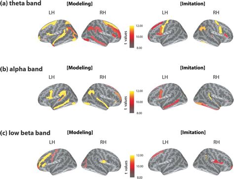 Interbrain Synchrony Of Homologous Areas Statistical Comparisons Of
