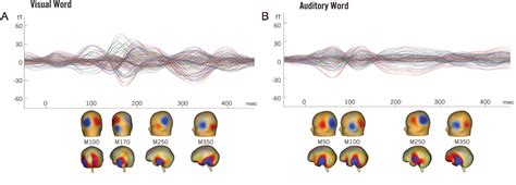 Figure 1 From Basic Linguistic Composition Recruits The Left Anterior Temporal Lobe And Left