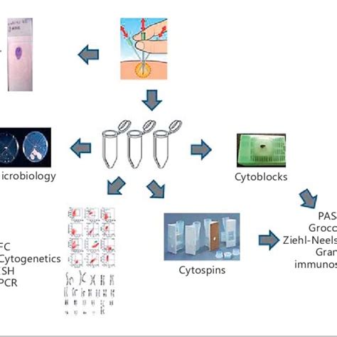 immunohistochemical algorithm for the classification of dlbc hans