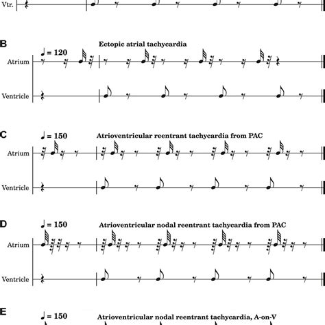 The Heart The Heart Added A New Photo