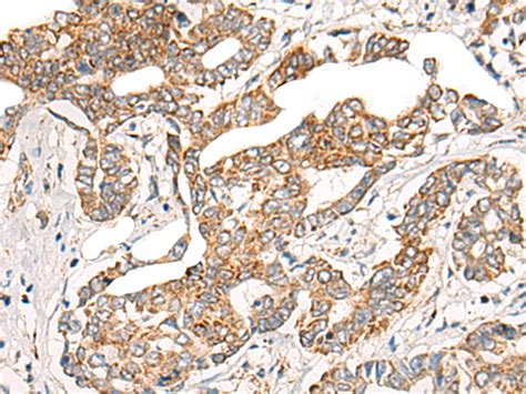 兔抗cgref1多克隆抗体anti Cgref1 Rabbit Polyclonal Antibody 生命科学产品与技术服务 生工生物工程