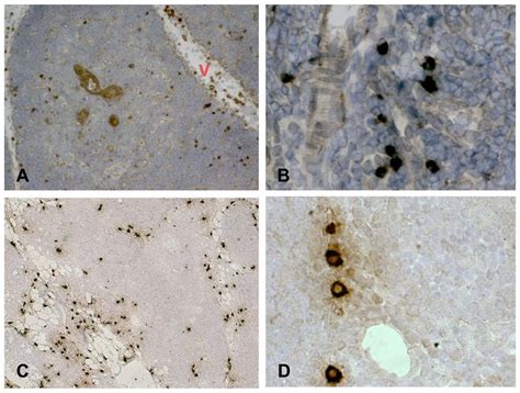 Am Distribution In Thymic Mast Cells In Cryostat Sections Of Human Download Scientific Diagram