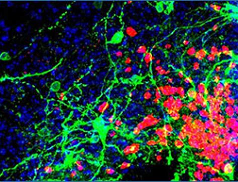 Comparison Of Atopic Dermatitis Transcriptome Profiling By Microarray And Rna Seq Rna Seq Blog