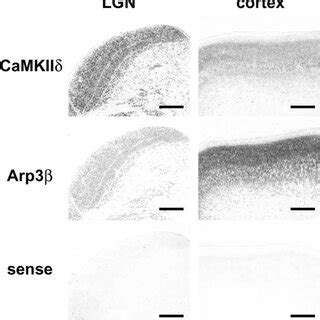 Validation Of Microarray Data By In Situ Hybridization Consistent With Download Scientific