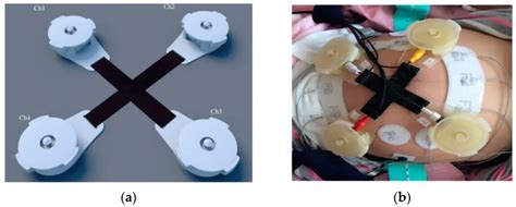 Non Invasive Glucose And ECG Levels Monitoring Arduino Smartech