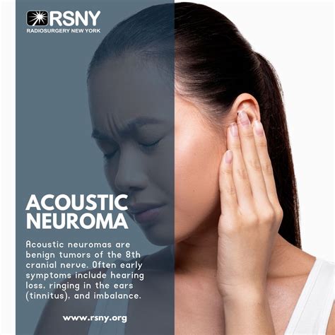 Ariel Lederman On Linkedin Drariellederman Radiosurgerynewyork