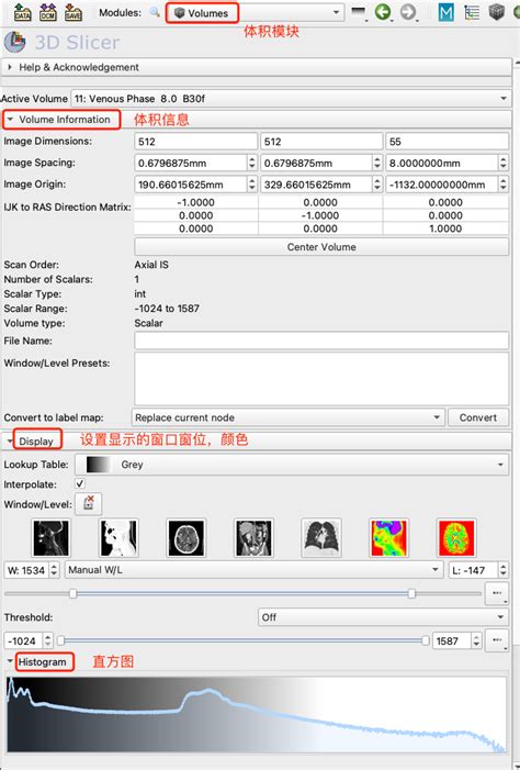 3d Slicer 最强大的开源医学图像分割工具简要概述3dslicer Csdn博客