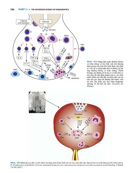 Chương 14 Pathway Bệnh Lý Cận Chóp Ab