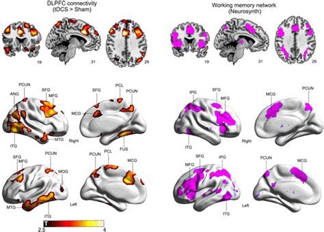 Anodal Tdcs Stimulation Increases The Functional Connectivity Of The Download Scientific
