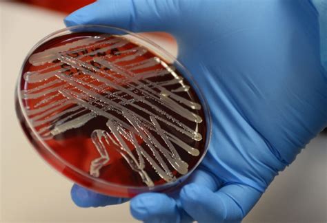 All About Rna Sequencing For Bacterial Transcriptomes