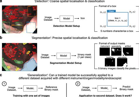 the three sub challenges of the endoscopy artefact detection ead