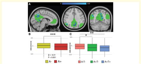 Dynamic Functional Connectivity Eigenvector Centrality In The Default