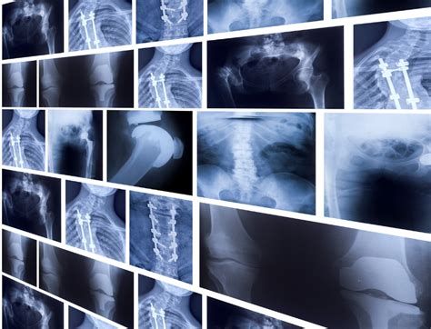 Medical Data Annotation What You Need To Know