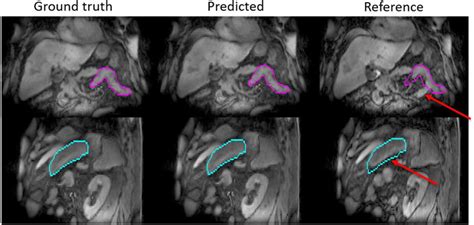 Example Slow Drifting Motion Prediction Results Contours Of Gi