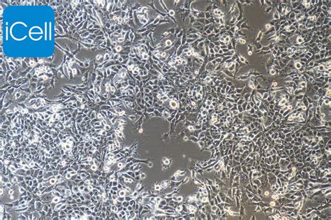 Gl261 Luc 小鼠胶质细胞瘤 Luc 原代细胞 Str细胞 细胞培养基 镜像绮点生物