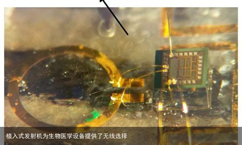 植入式发射机为生物医学设备提供了无线选择 云恒制造