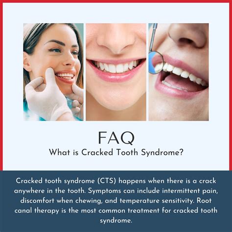 California Cracked Tooth Syndrome Cts Happens When There Is A Crack