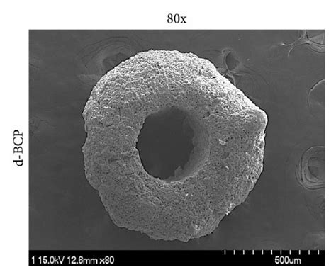 Morphology Of The Donut Shape Of Microporous Biphasic Calcium Phosphate Download Scientific