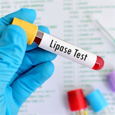 Slightly Elevated Lipase 5 Causes And When To Worry Gastroenterologist